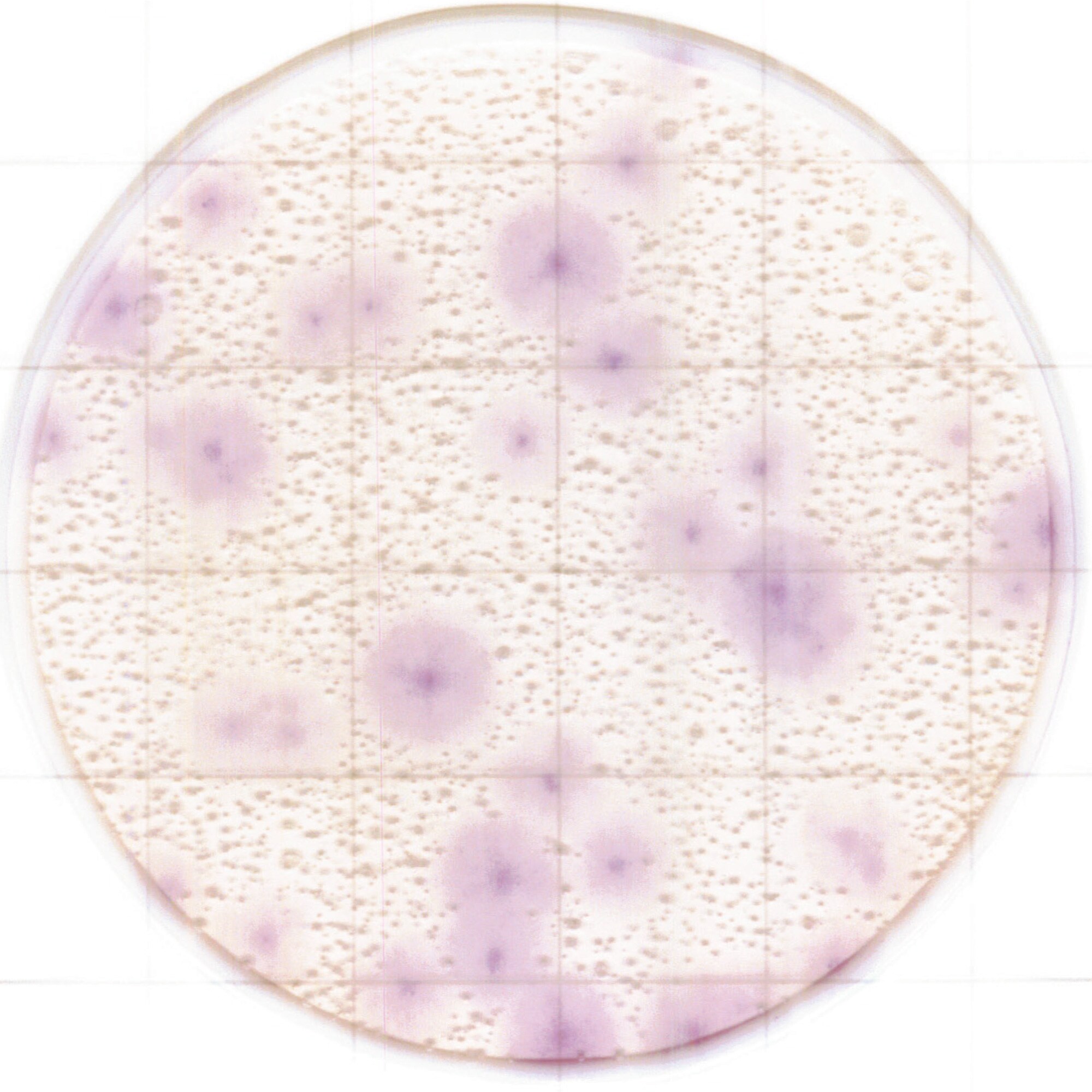 【培地】真菌（カビ・酵母）数測定用 Easy Plate YM-R｜Easy_Plate